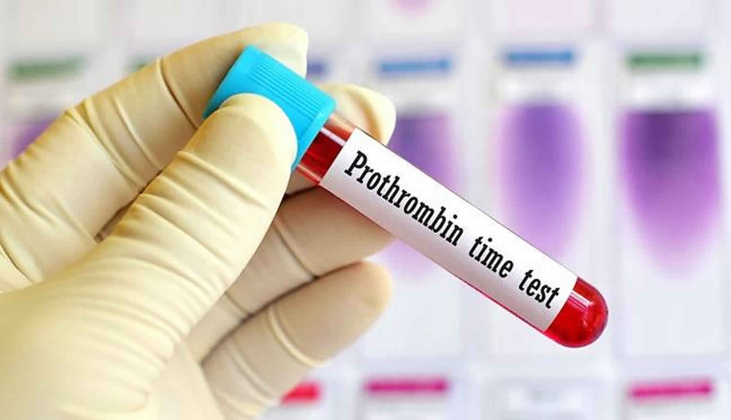 Plasma Prothrombin Time (PT/INR) - Pemeriksaan, dan Prosedur ...
