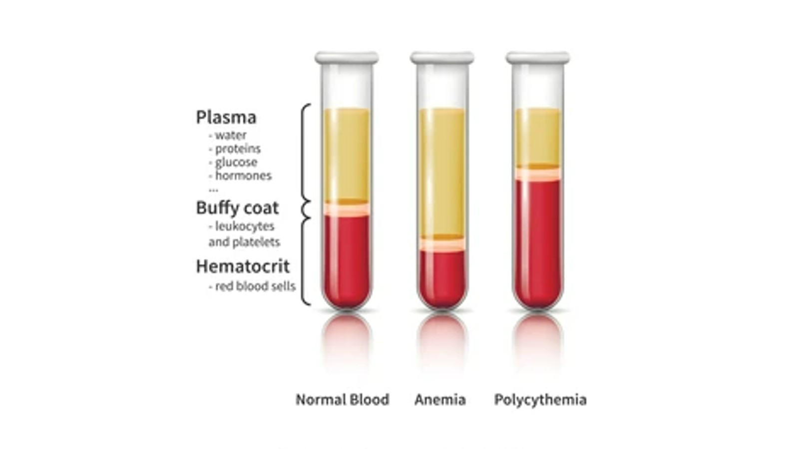 Penyakit Polisitemia - Definisi, Penyebab, Gejala, dan Tata Laksana ...