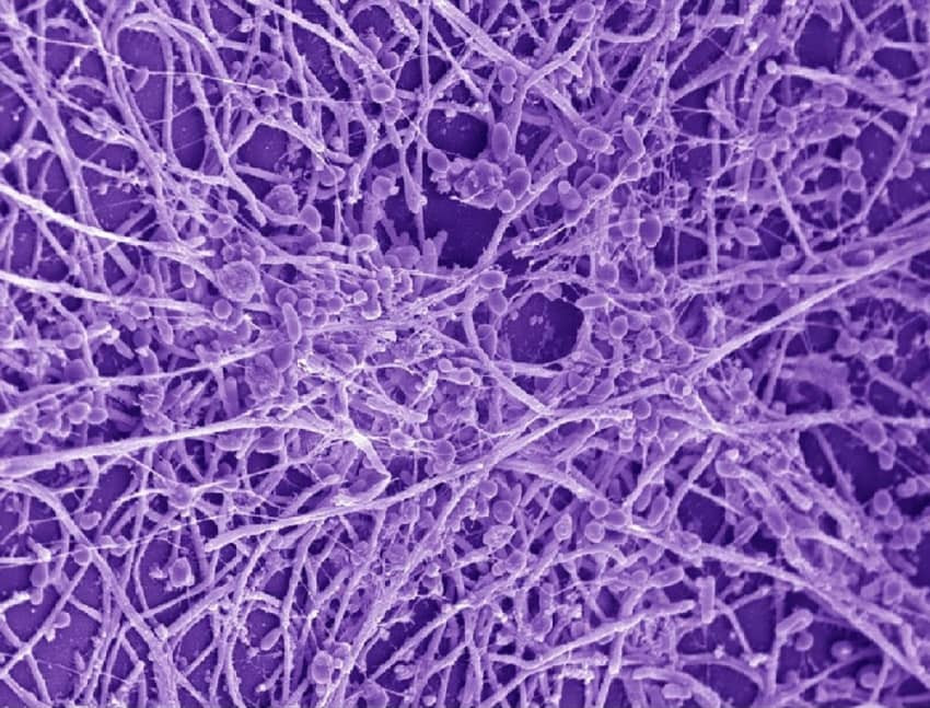 Candidiasis - Definition, Causes, Symptoms, and Treatment | AI Care
