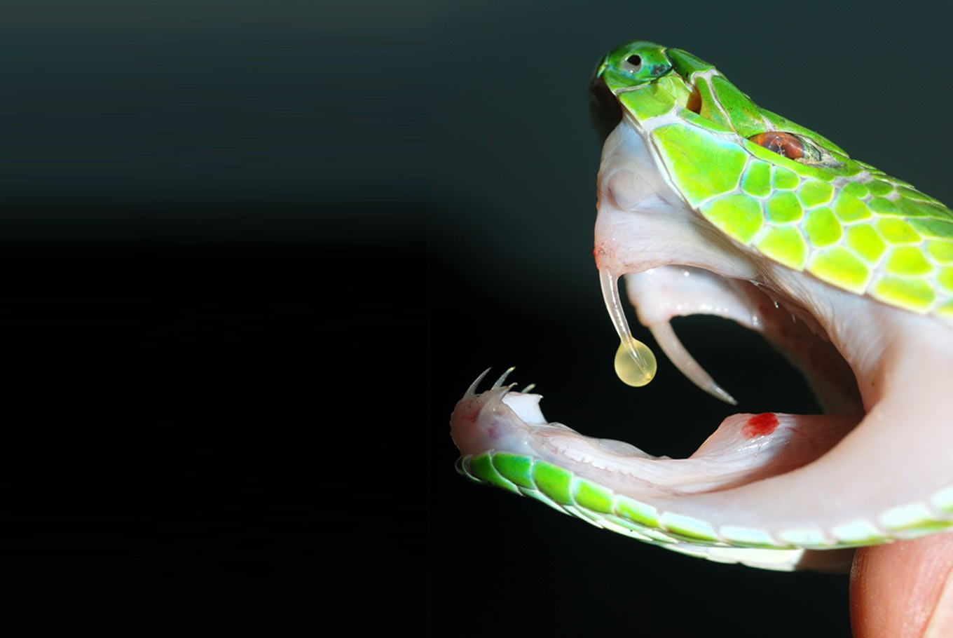 Venomous Snake Bite - Definisi, Penyebab, Gejala, dan Tata Laksana | AI ...