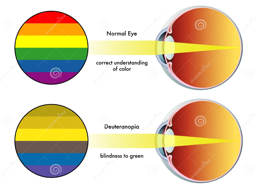 Mengenal Jenis-Jenis Buta Warna | AI Care