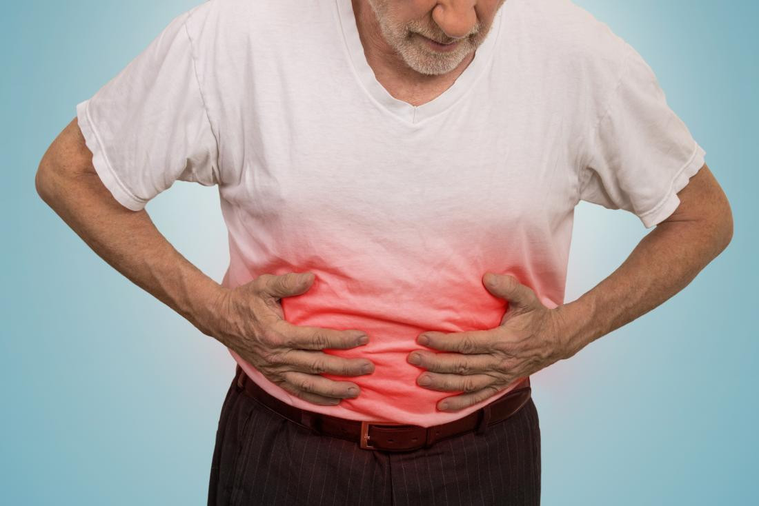 Obstructive Ileus - Definition, Causes, Symptoms, and Treatment | AI Care