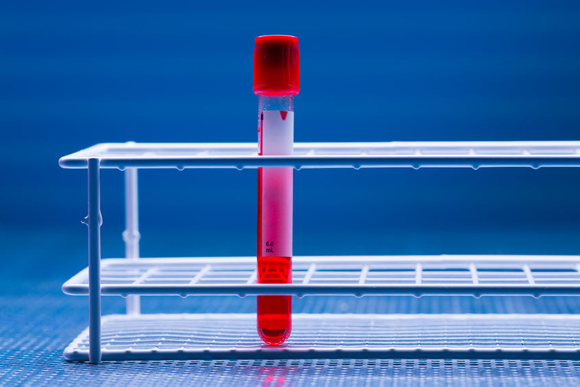 Retikulosit - Pemeriksaan, dan Prosedur pemeriksaan | AI Care