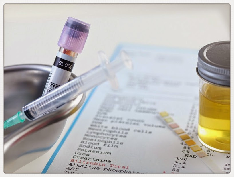 Differential Blood Count - Examination, and Examination Procedures | AI ...